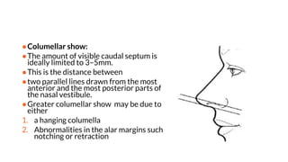 Basic principle of rhinoplasty. by venukumar.t | PPTX