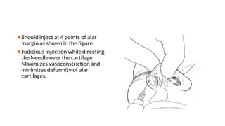 Basic principle of rhinoplasty. by venukumar.t | PPTX