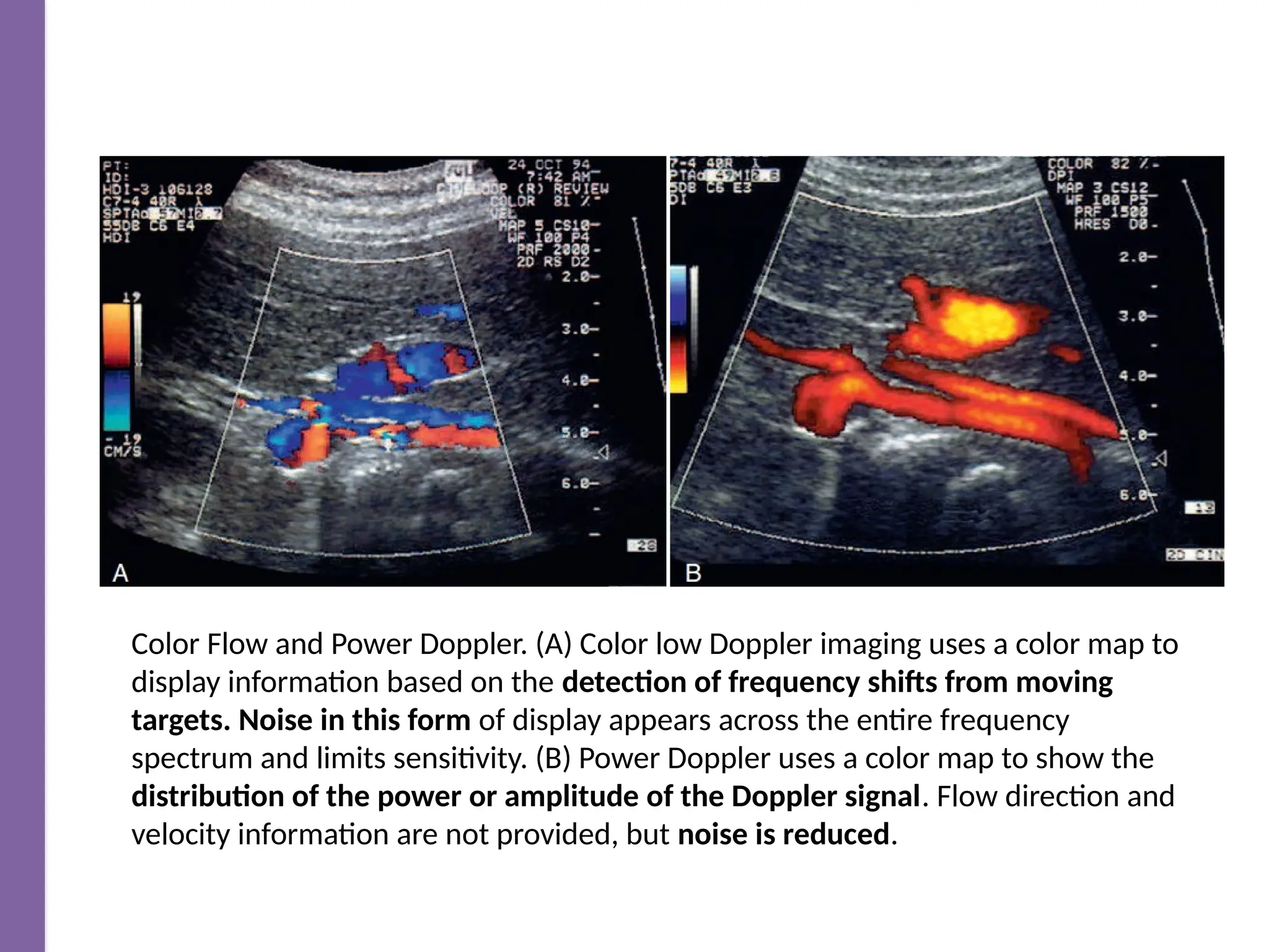 Basic principle of Ultrasound and It's advancements by Joginder.pptx