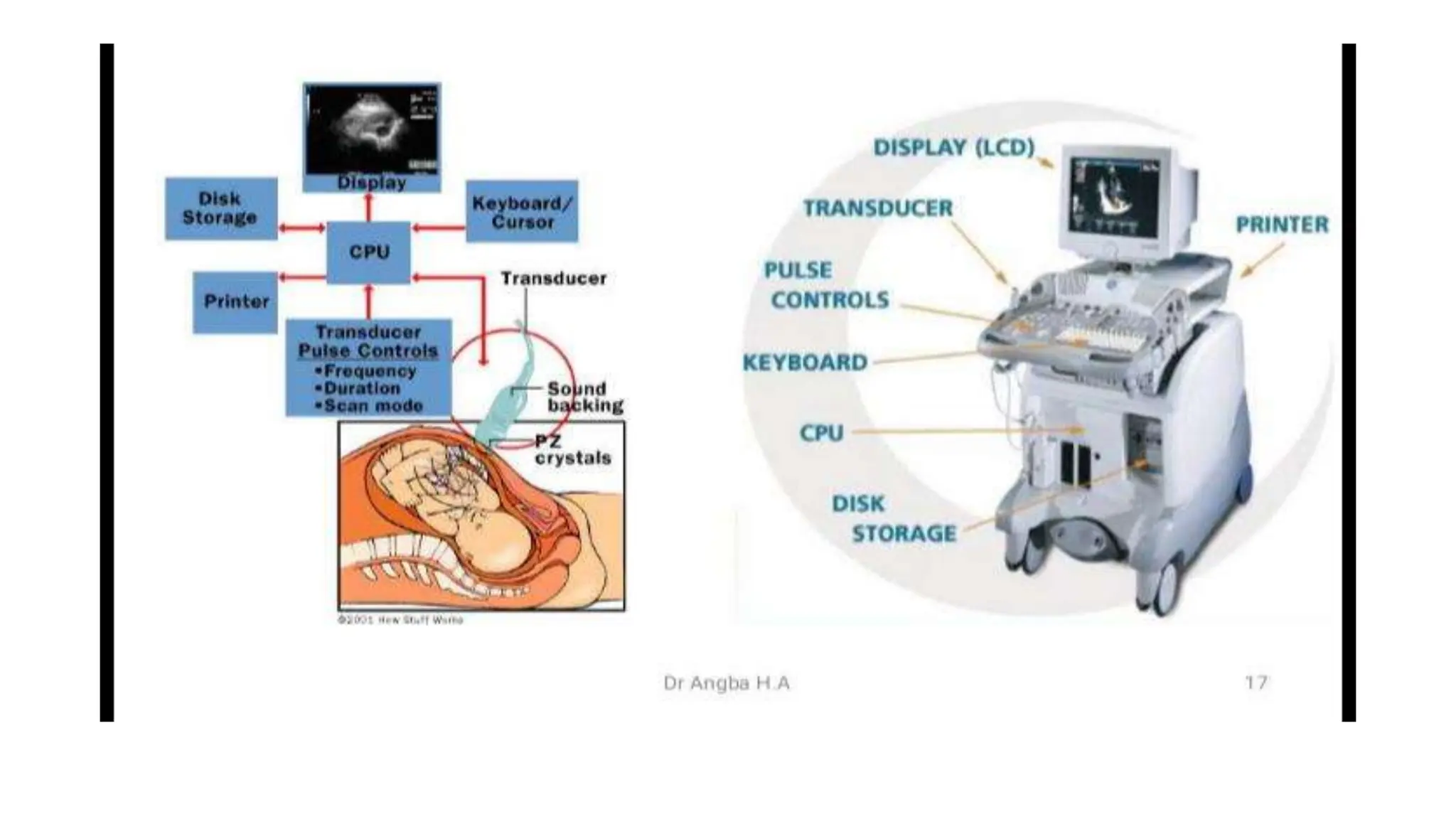 Basic Principle of Ultra Sound Scan.pptx