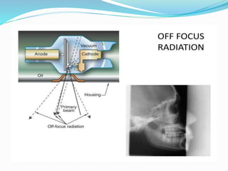 Basic principle of x ray | PPTX