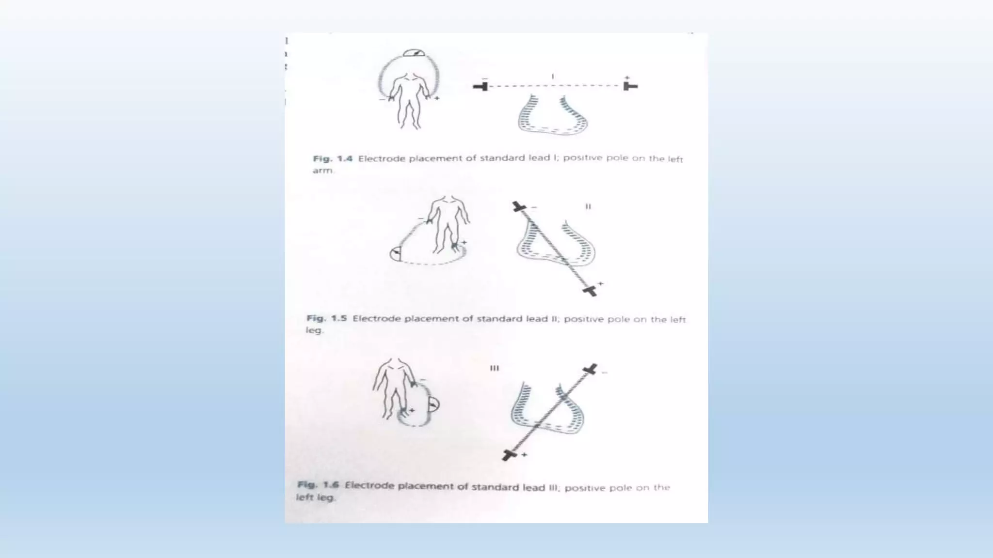 BASICS OF ECG pptx.pptx