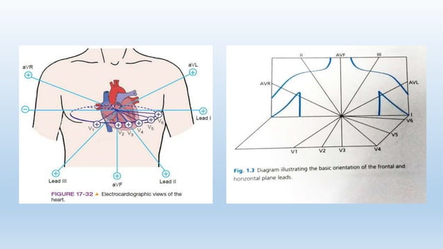BASICS OF ECG pptx.pptx