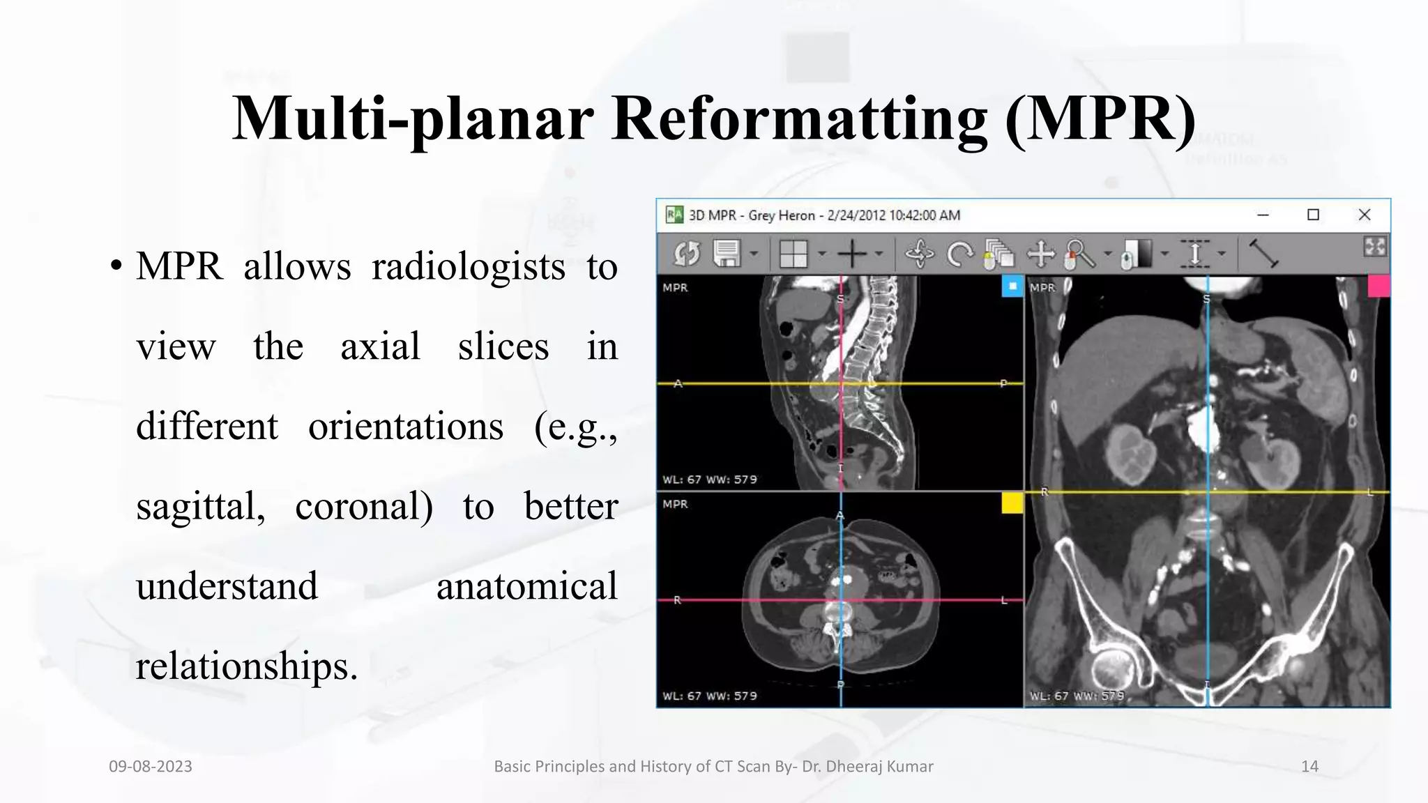 Basic Principles and History of CT Scan.pptx
