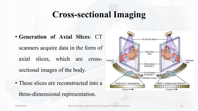 Basic Principles and History of CT Scan.pptx | Medical Tests | Medical ...