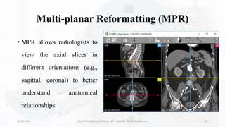 Basic Principles and History of CT Scan.pptx