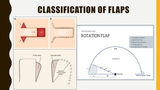 Basic principles and techniques of microsurgery - Dr. Sachin. M. | PPTX