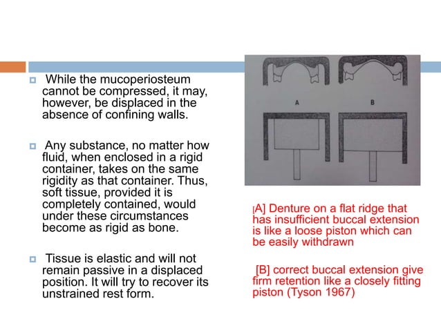 Basic principles in impression making | PPT