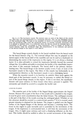 Basic principles in impression making 4 | PDF