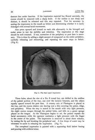 Basic principles in impression making 6 | PDF