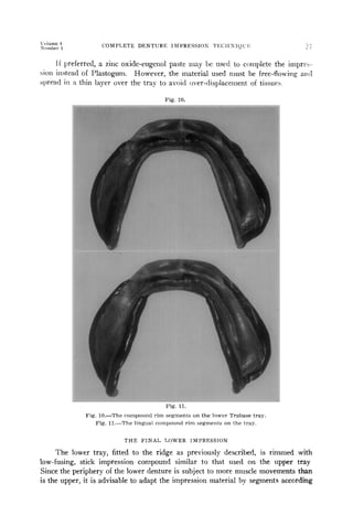 Basic principles in impression making 6 | PDF