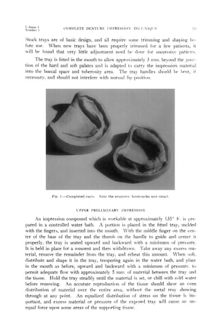 Basic principles in impression making 6 | PDF