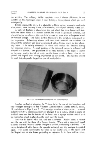 Basic principles in impression making 6 | PDF