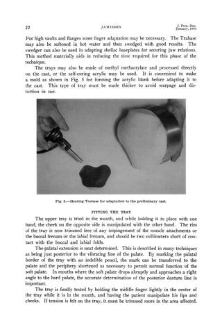 Basic principles in impression making 6 | PDF