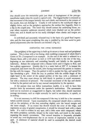 Basic principles in impression making 6 | PDF