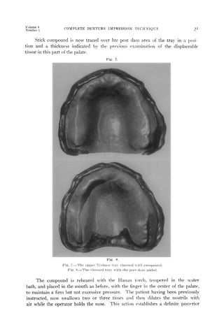 Basic principles in impression making 6 | PDF