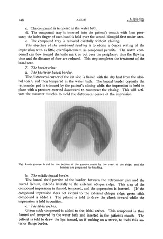 Basic principles in impression making 7 | PDF