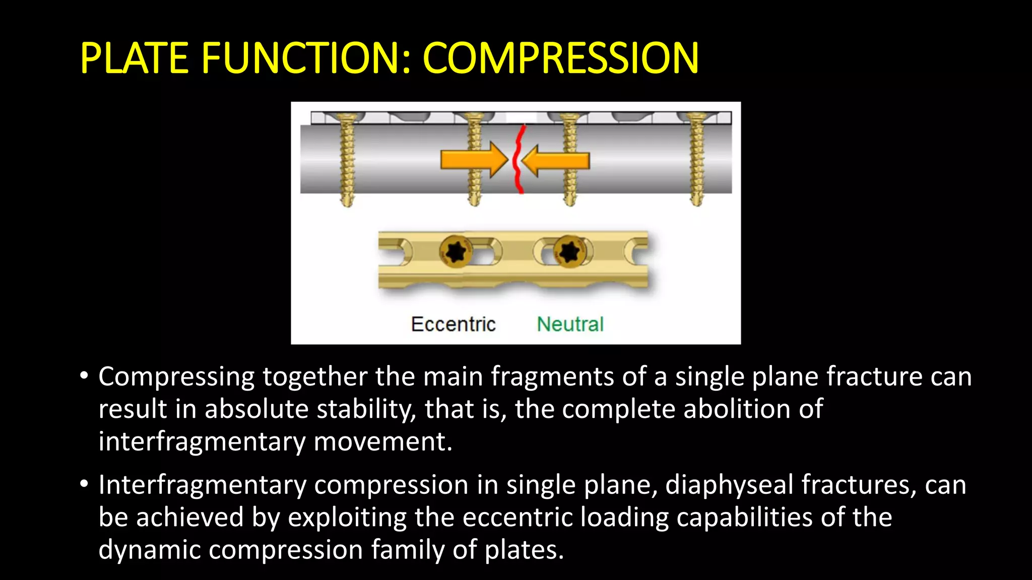 Basic principles internal fixation | PDF