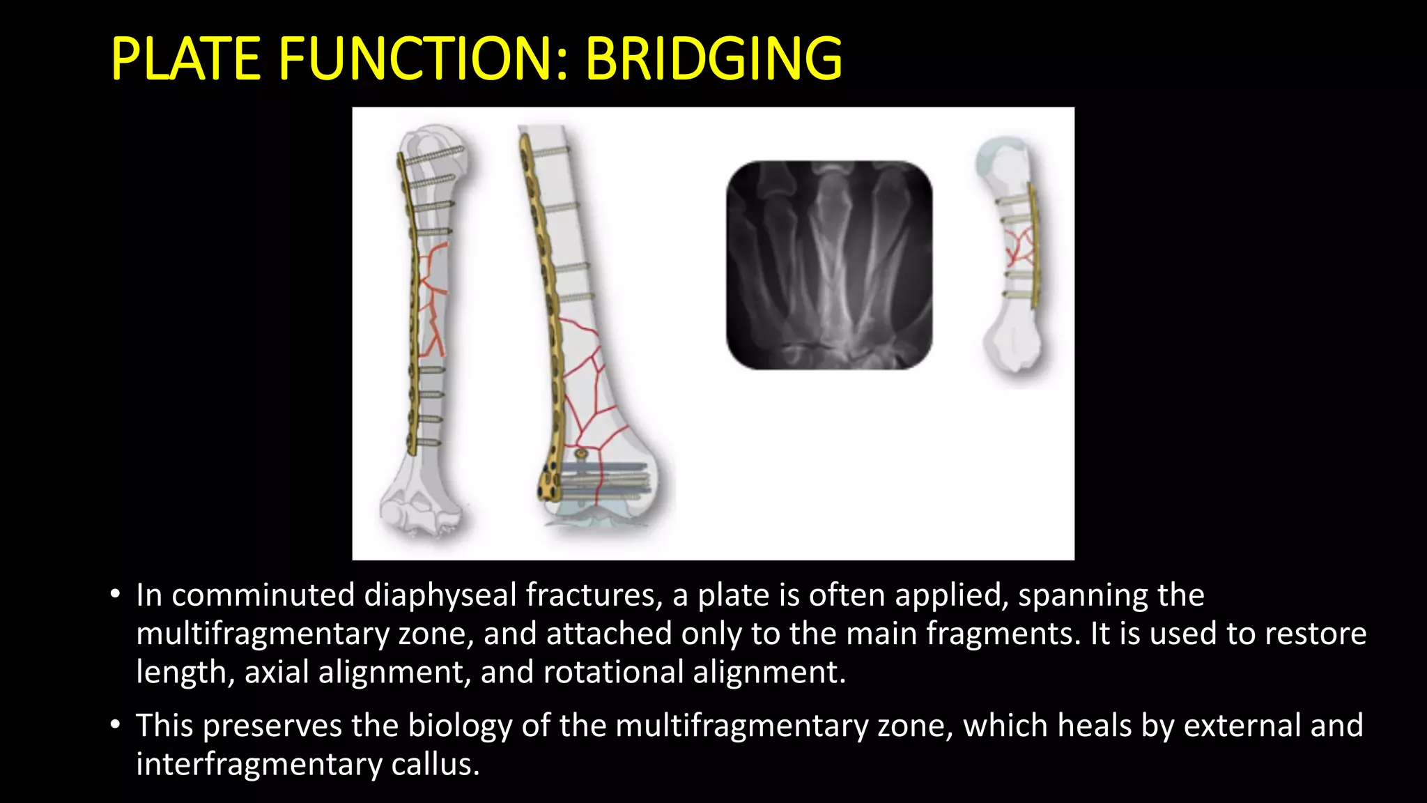 Basic principles internal fixation | PDF