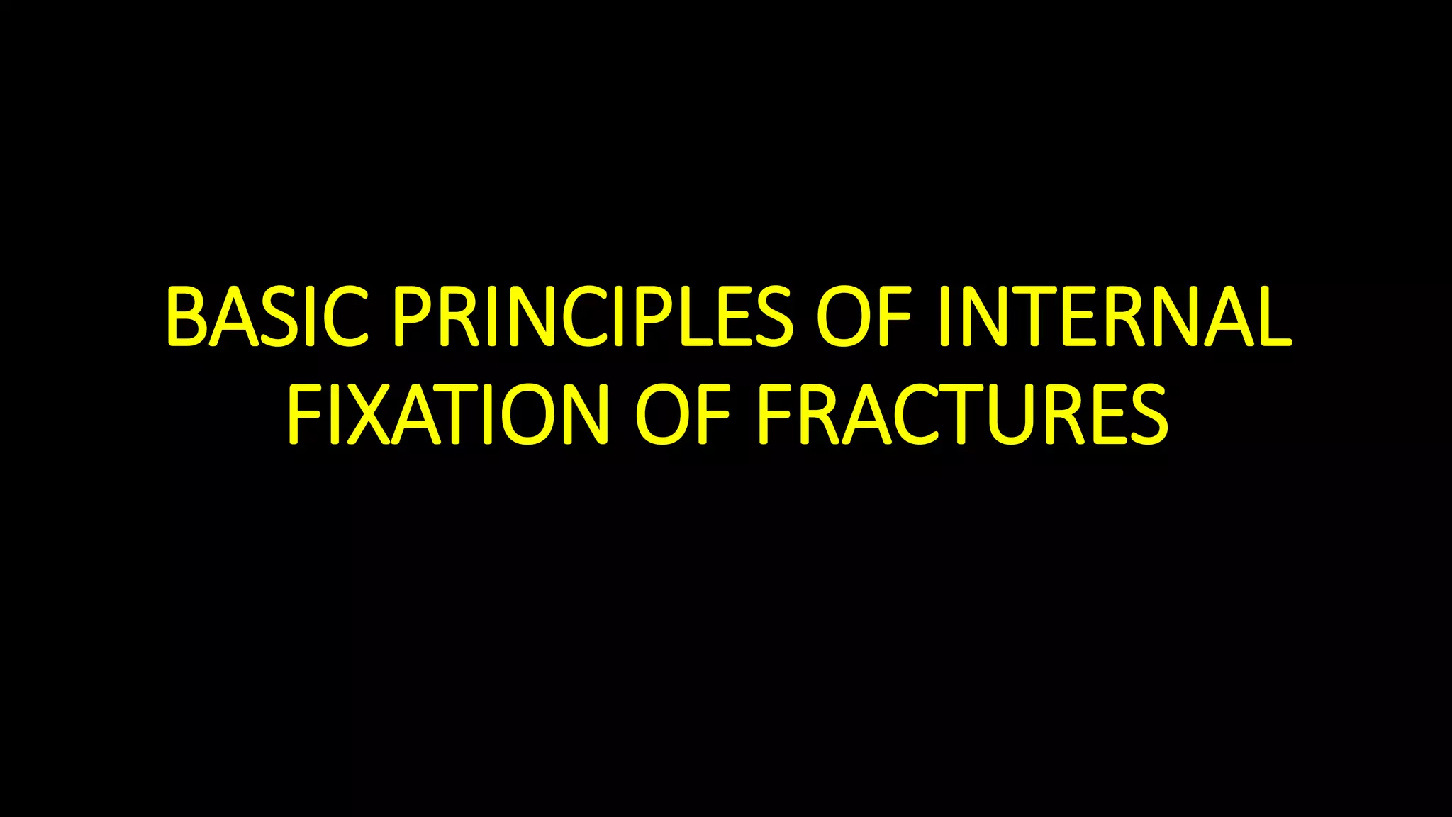 Basic principles internal fixation | PPT