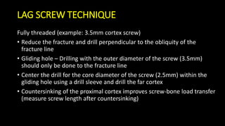 Basic principles internal fixation | PDF