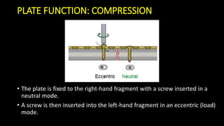Basic principles internal fixation | PDF