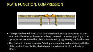 Basic principles internal fixation | PDF