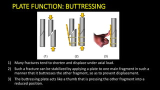 Basic principles internal fixation | PDF