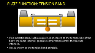 Basic principles internal fixation | PDF