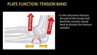 Basic principles internal fixation | PDF