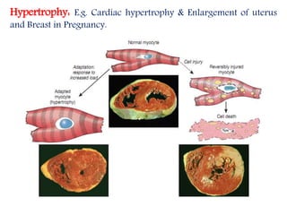 Basic principles of cell injury | PPTX