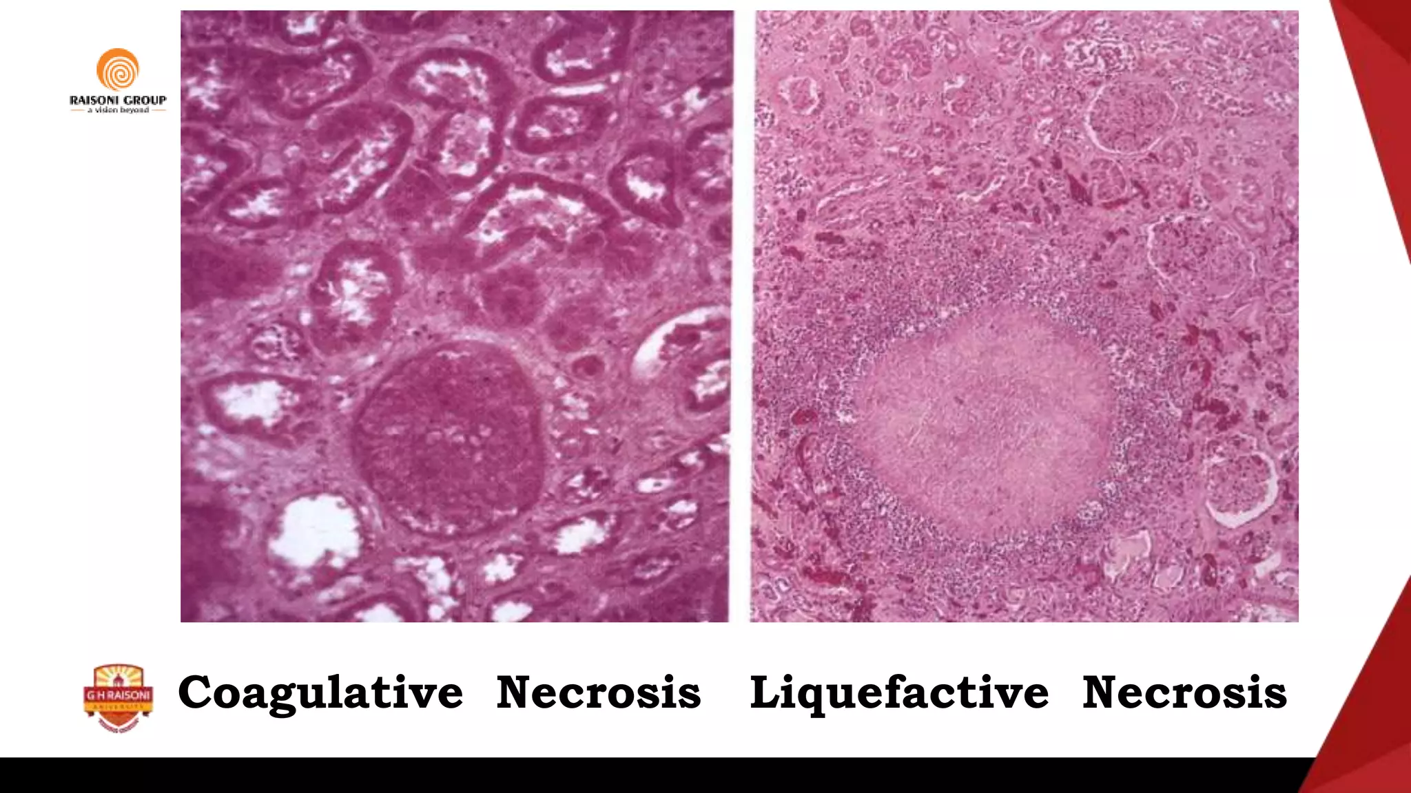 Basic Principles of Cell Injury and Adaptation.pptx