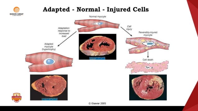 Basic Principles of Cell Injury and Adaptation.pptx | Biological ...