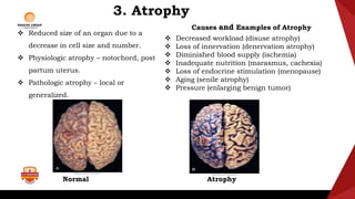Basic Principles of Cell Injury and Adaptation.pptx