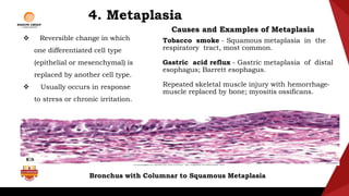 Basic Principles of Cell Injury and Adaptation.pptx