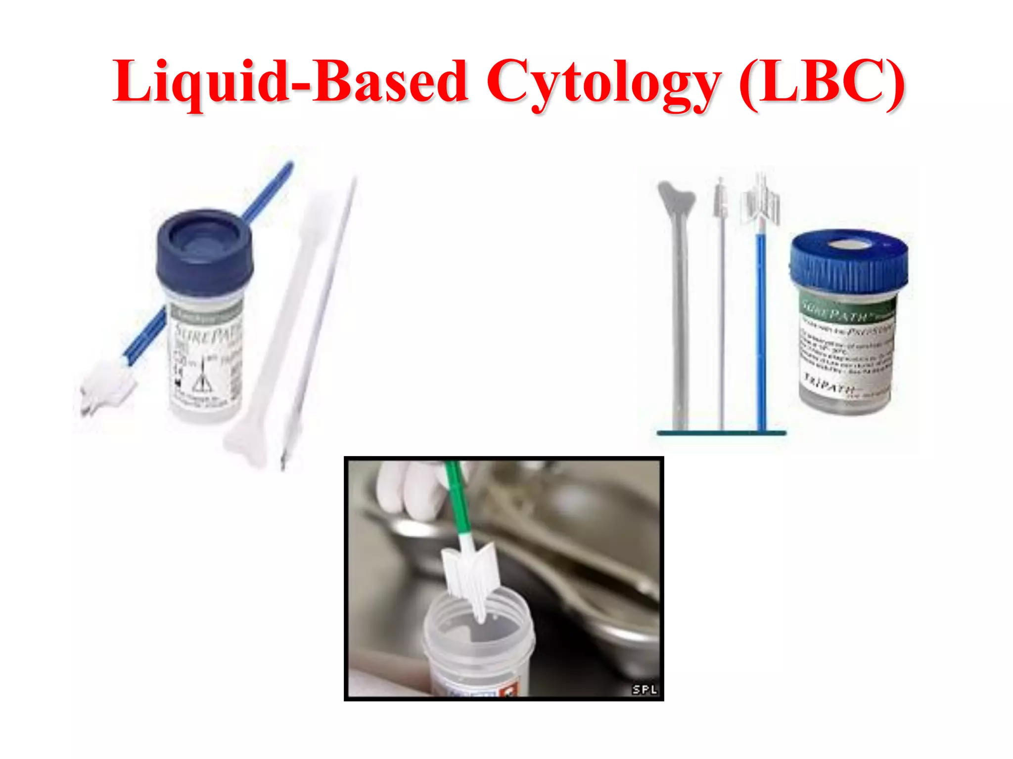 Dr Ayman Ewies - Basic principles of colposcopy 2009 | PDF