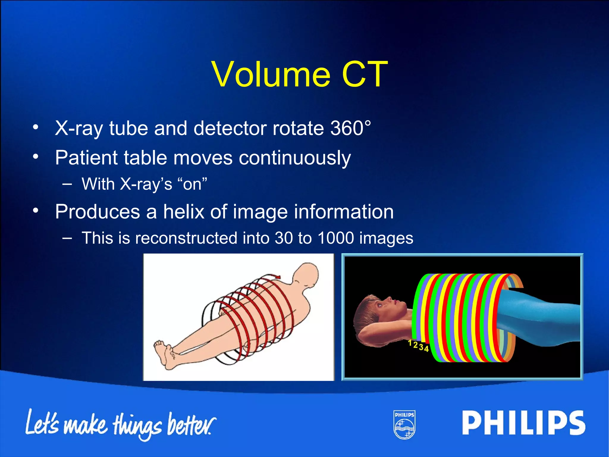 Basic principles of ct scanning | PPT