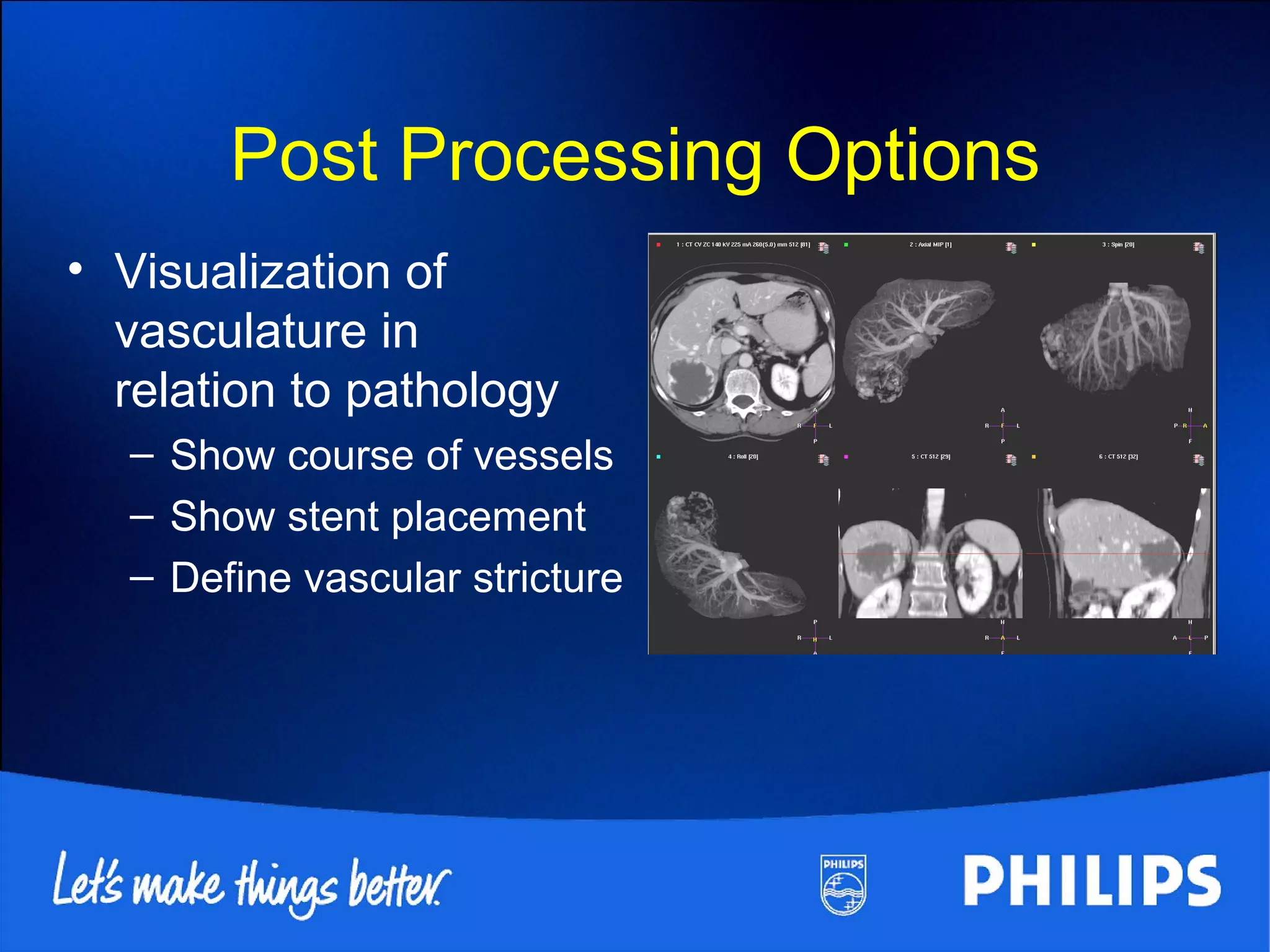 Basic principles of ct scanning | PPT