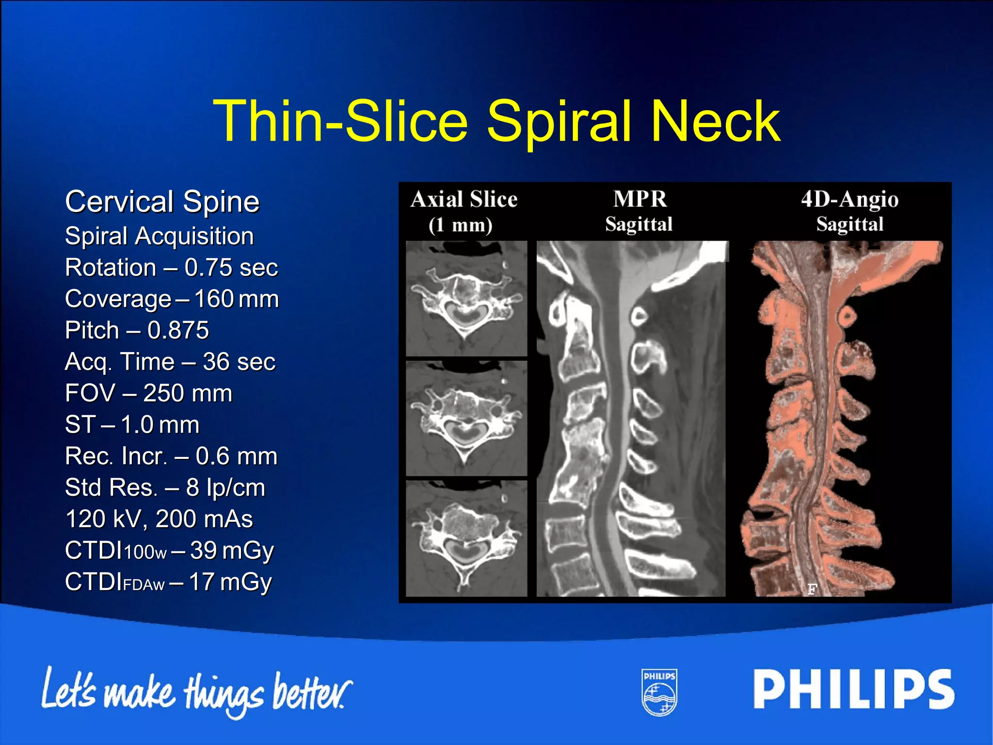 Basic principles of ct scanning | PPT
