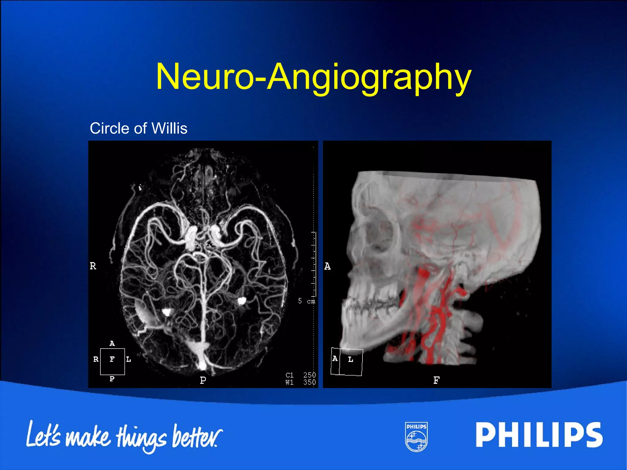 Basic principles of ct scanning | PPT