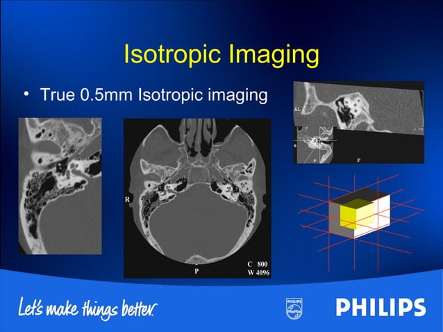Basic principles of ct scanning | PPT | Medical Tests | Medical Health