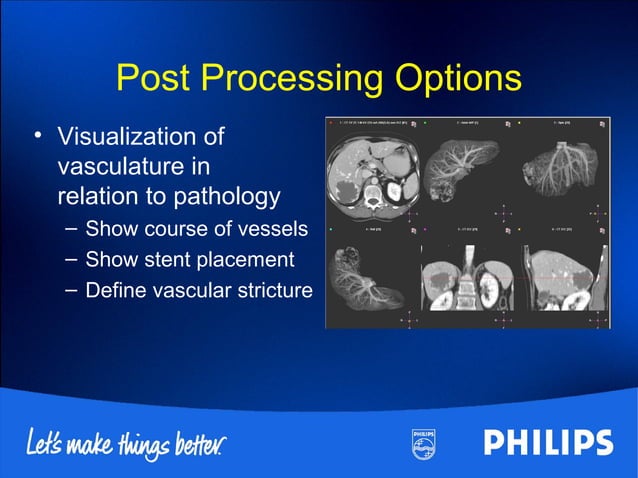 Basic principles of ct scanning | PPT | Medical Tests | Medical Health