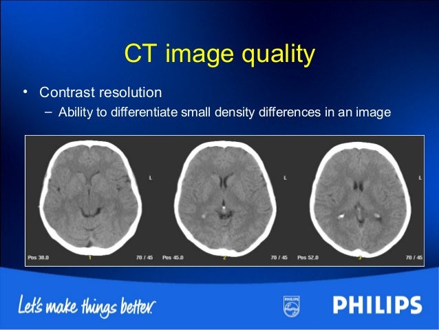 Basic principles of ct scanning