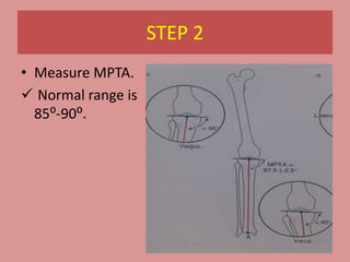 Basic principles of deformity correction | PPTX