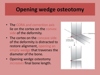 Basic principles of deformity correction | PPTX