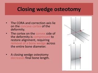 Basic principles of deformity correction | PPTX