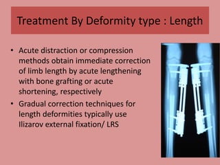 Basic principles of deformity correction | PPTX