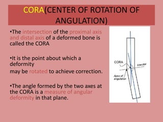 Basic principles of deformity correction | PPT
