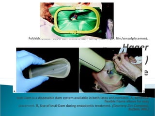 Basic principles of endodontics | PPT