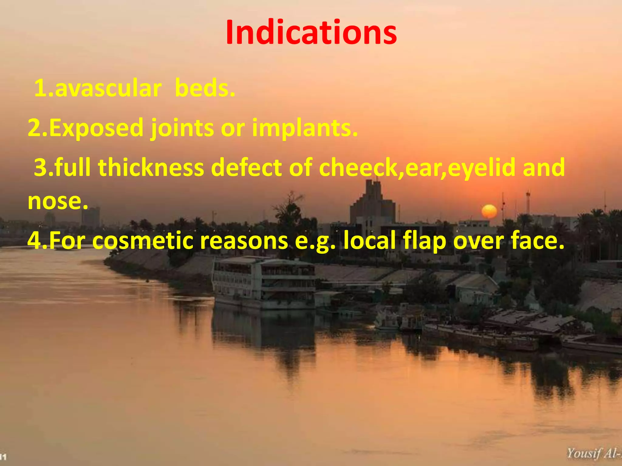 Basic principles of flaps | PPSX